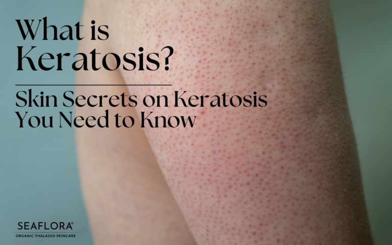 Keratosis Pilaris: Types, Treatments, and Prevention Tips